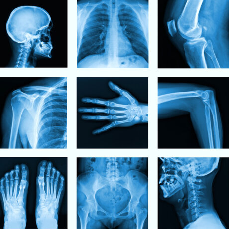 [Sélection] Alter-Paces, réforme du 3e cycle, bizutage, bourses... l ...